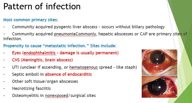 Hypervirulent (Hypermucoviscous) Klebsiella – 09/06/2017 (Presented by ...