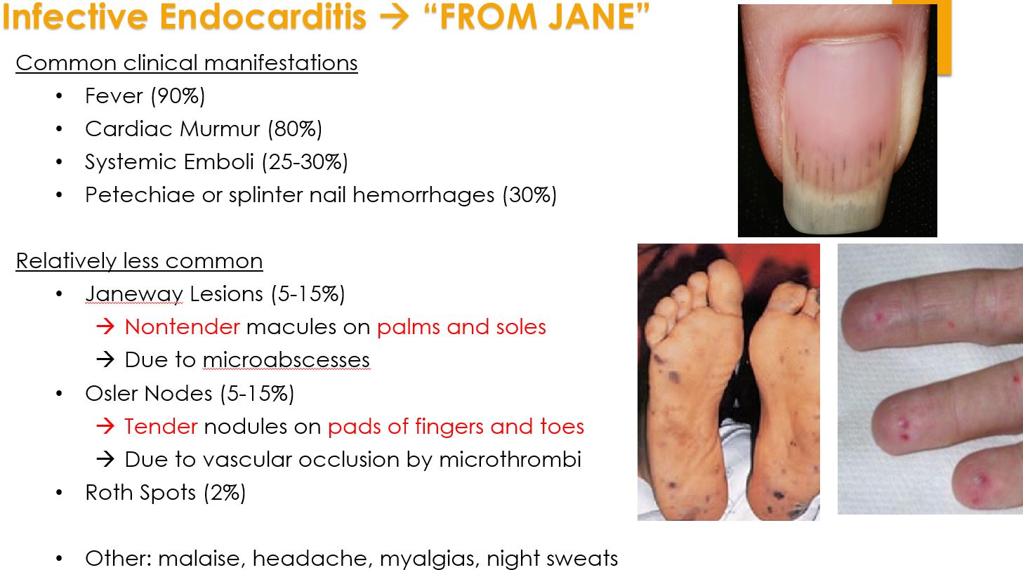 Lesiones De Janeway Endocarditis On X: "Otros Síntomas Relacionados