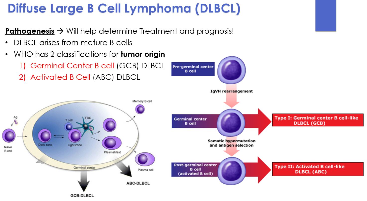 Diffuse Large B-Cell Lymphoma DLBCL – 12/13/2017 | SCVMC IM Chief ...