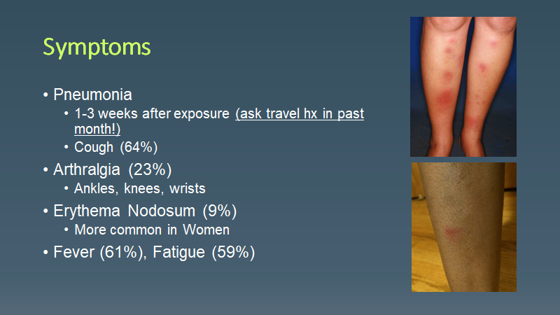 Coccidiomycosis | SCVMC IM Chief Resident Blog
